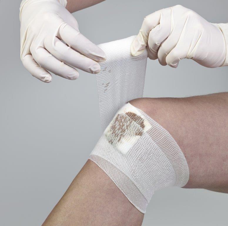 Feridas são "epidemia escondida" que precisa de formação específica ...