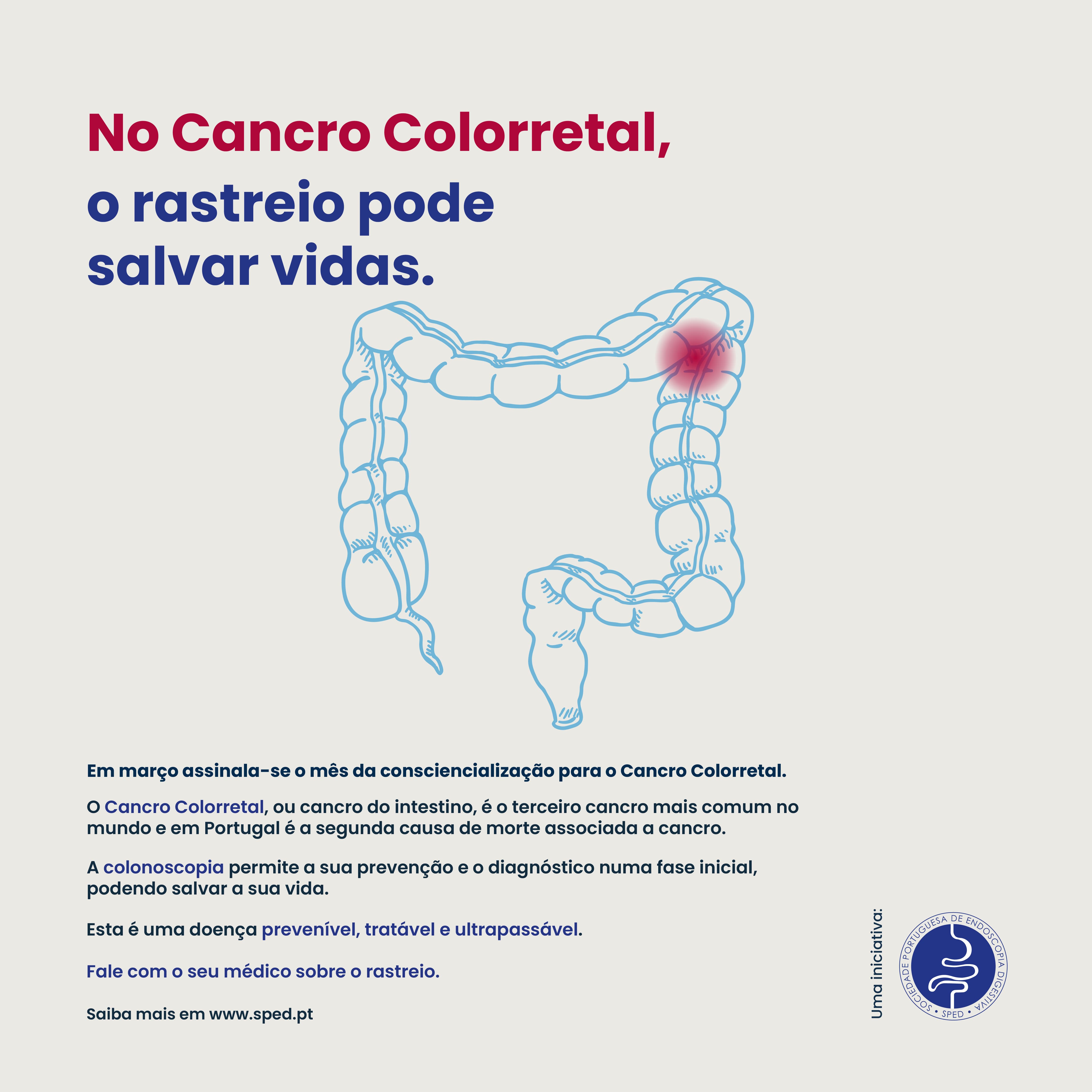 Médicos alertam para a importância do diagnóstico precoce do Cancro ...